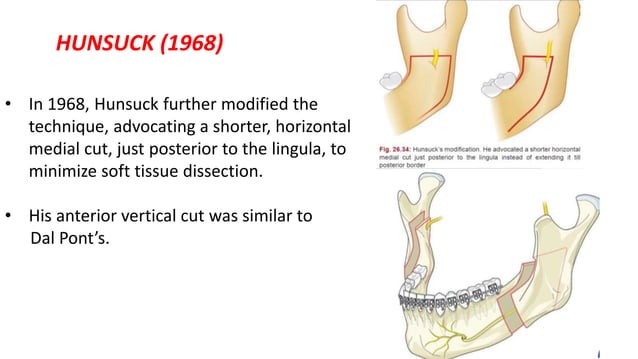Bsso | PPTX | Death, Injury, or Military Conflict | Sensitive Topics