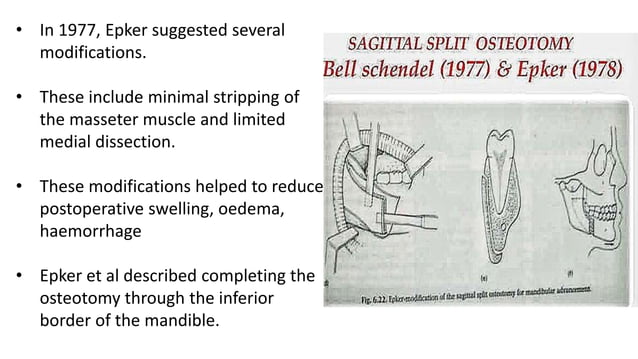 Bsso | PPTX | Death, Injury, or Military Conflict | Sensitive Topics
