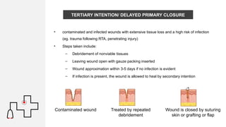 Basic surgical skill for medical student ppt.pptx