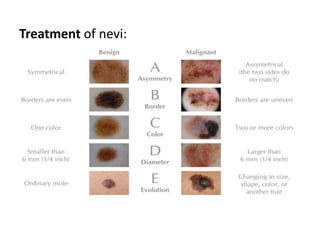 Malignant Tumor Skin