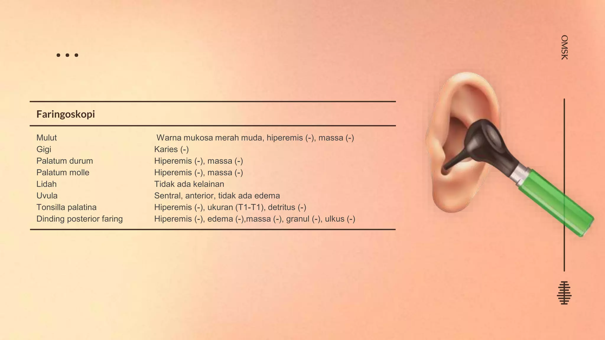 Otitis Media Supuratif Kronis | PPTX