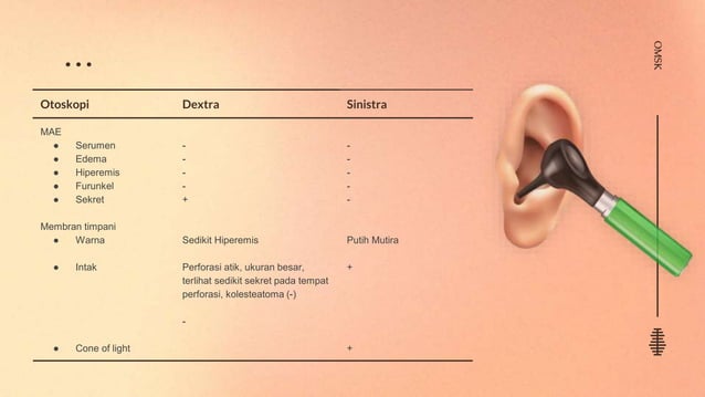 Otitis Media Supuratif Kronis | PPTX