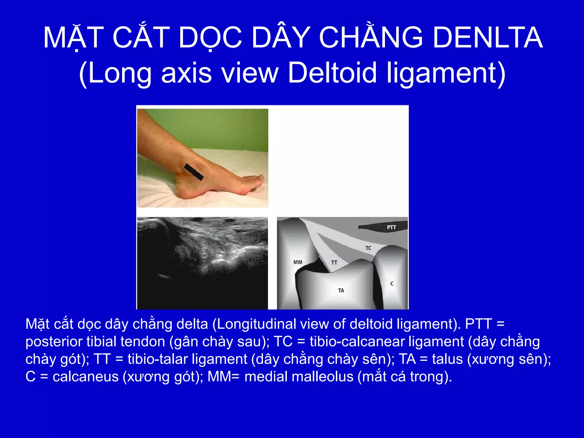 Siêu âm cổ chân bàn chân, Bs Tài | PDF