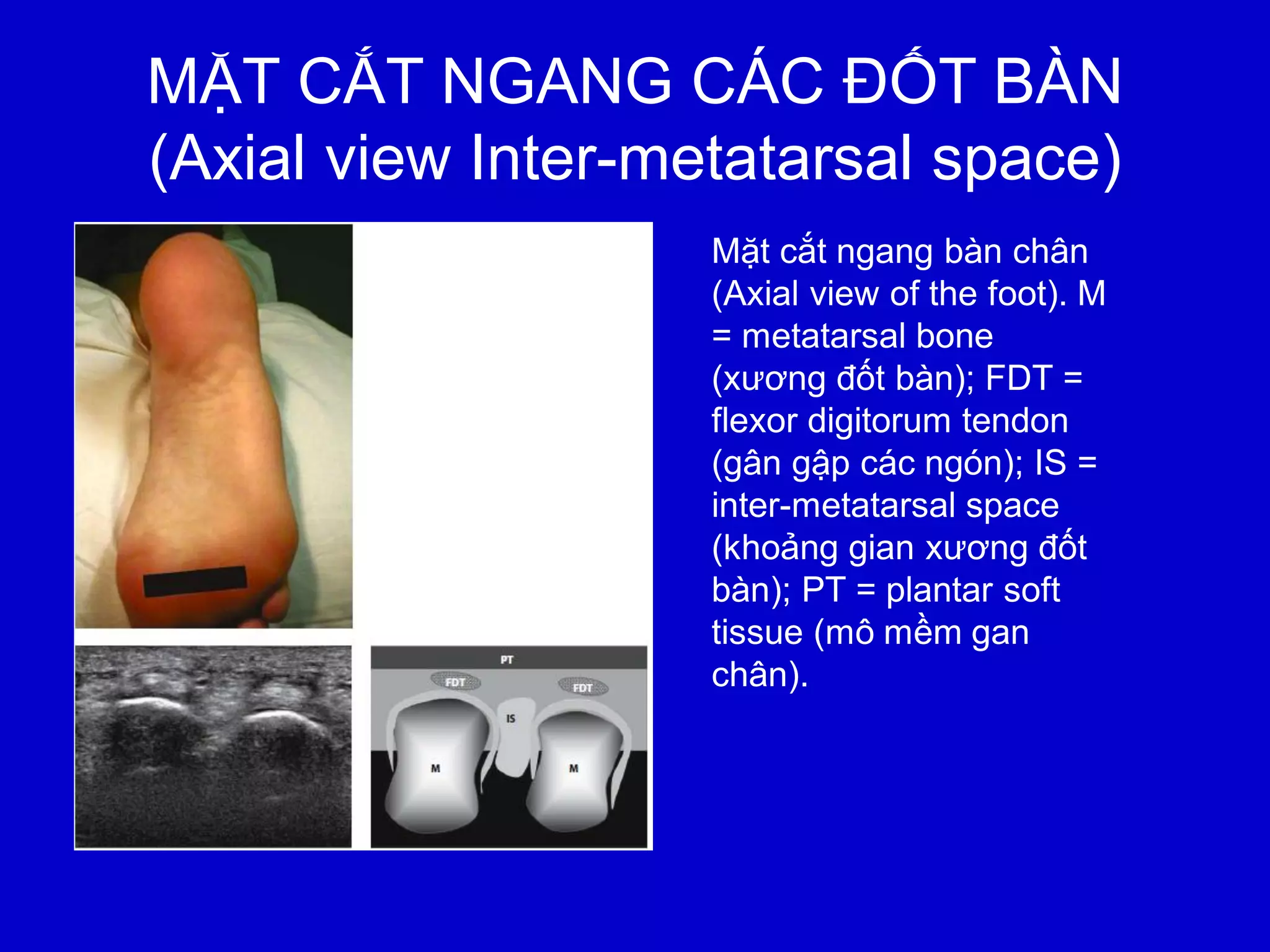 Siêu âm cổ chân bàn chân, Bs Tài | PDF | Death, Injury, or Military ...