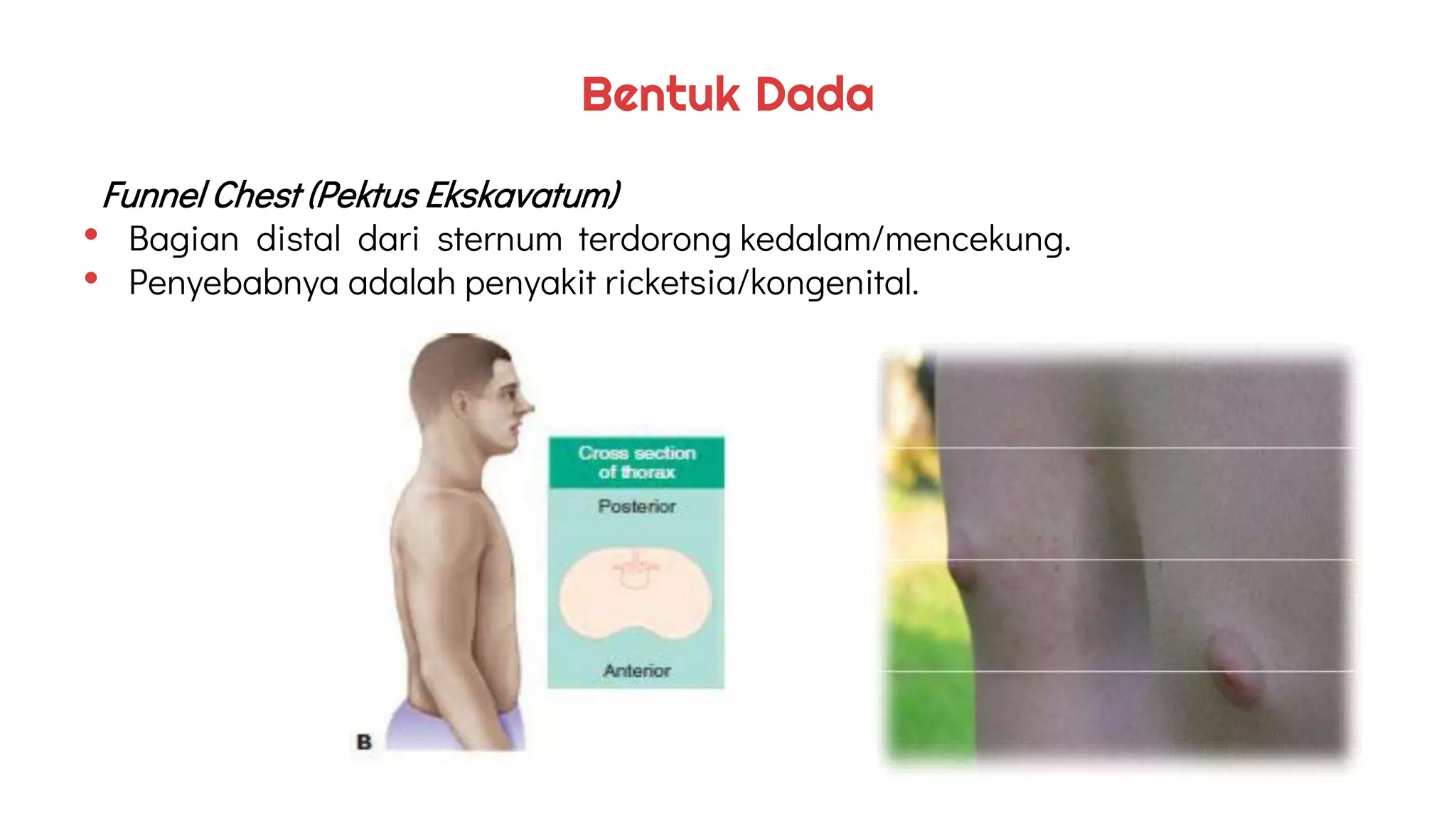 BST PEMFIS JANTUNG & PARU [REVISI].pptx