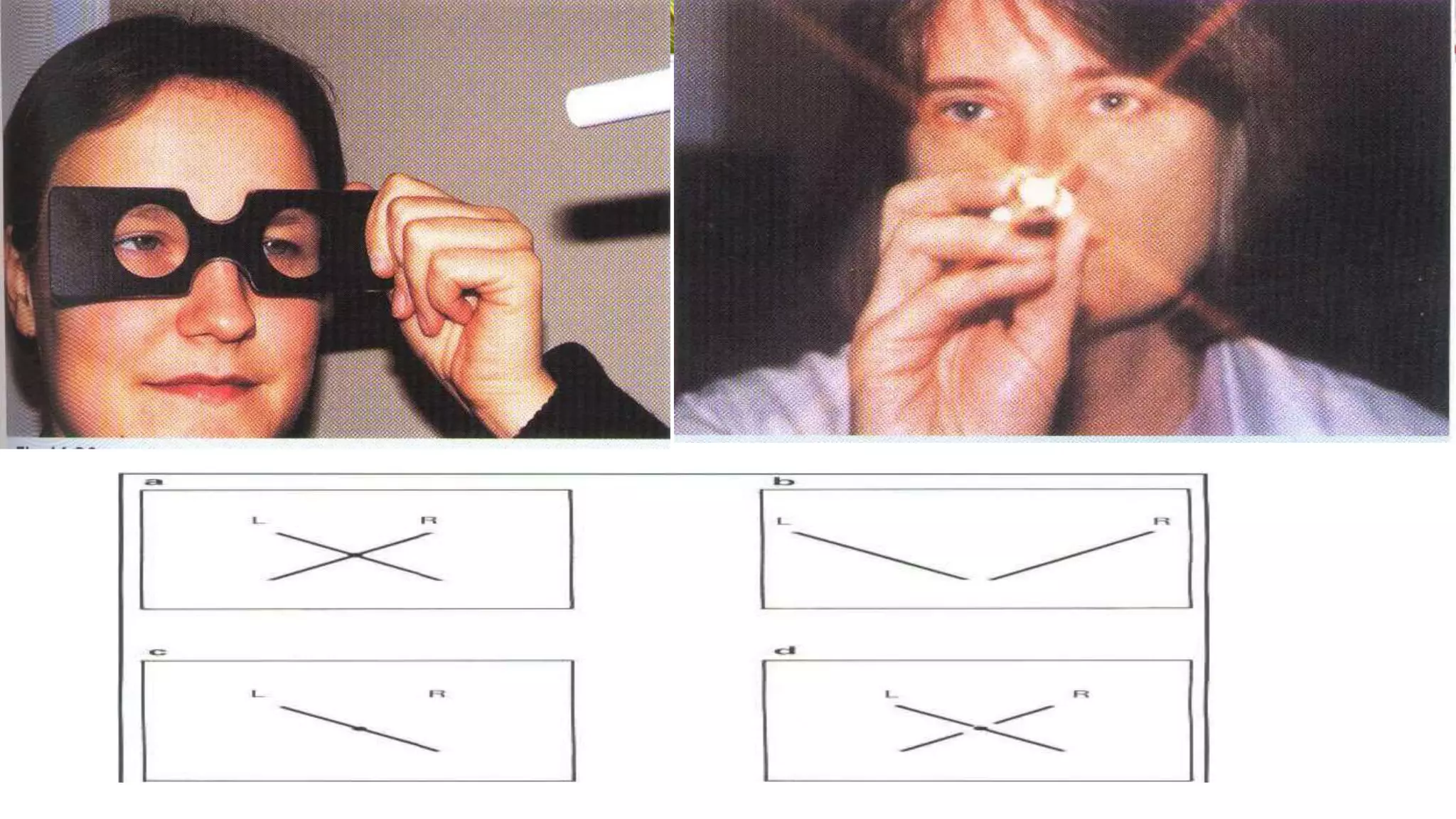 Binocular Single Vision Tests | PPTX
