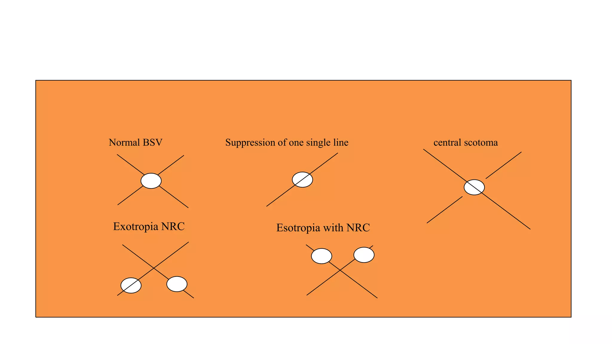 Binocular Single Vision Tests | PPTX