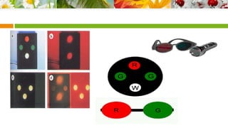 Binocular Single Vision Tests | PPTX