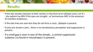 Binocular Single Vision Tests | PPTX