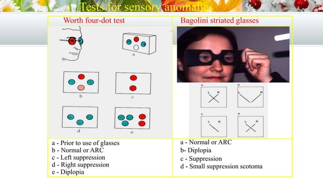 Binocular Single Vision Tests | PPTX