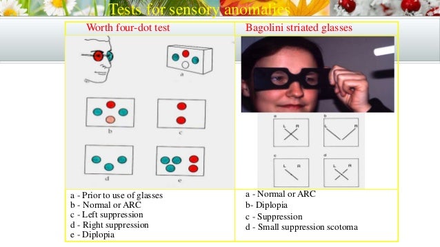 Binocular Single Vision Tests