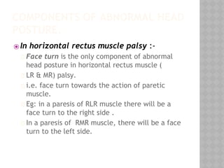 BSV- HEAD POSTURE. pptx orthoptics...... | PDF
