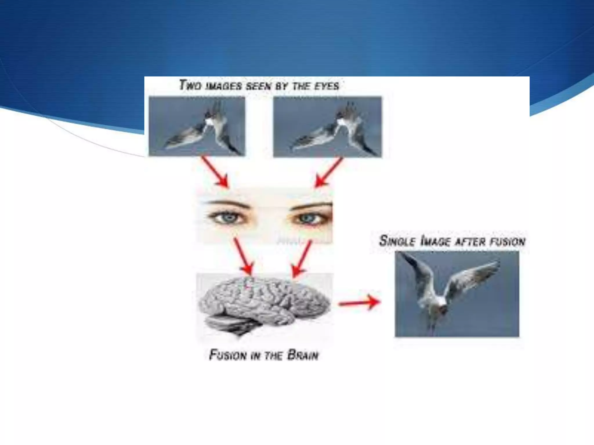 binocular single vision | PPTX