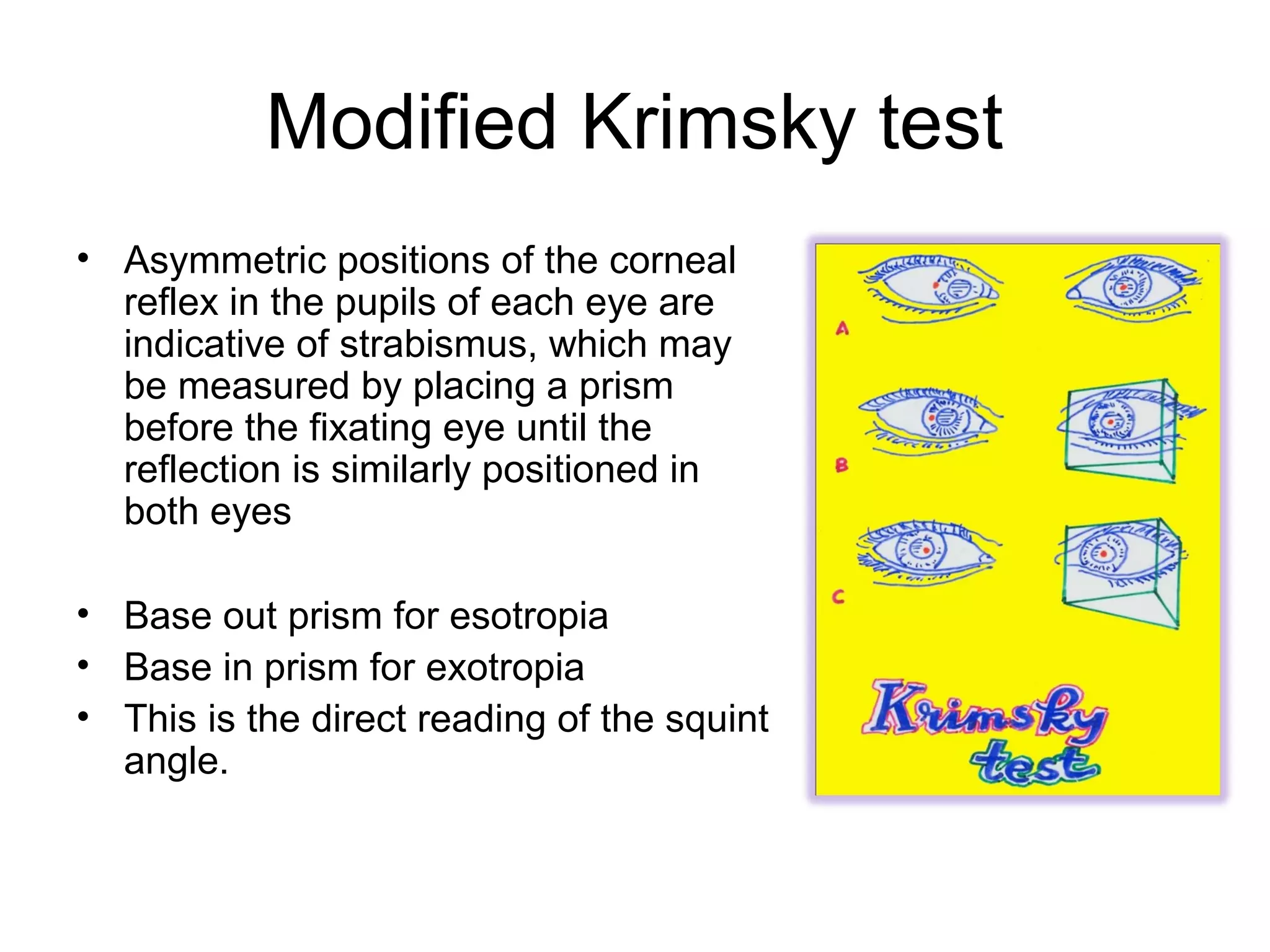 Gede Pardianto - Strabismus, binocular vision, 3D vision and visual ...
