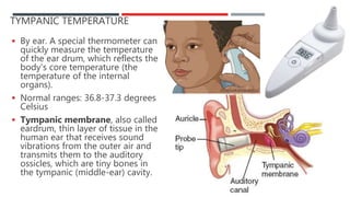 VS- TEMPERATURE (NORMAL,FORMULA, TYPES OF THERMOMETER, THERMORECEPTORS ...