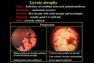 47 hereditary choroidal dystropathies | PPT