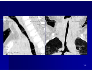 Radiology in Congenital Pulmonary Diseases - HCM UMP | PDF