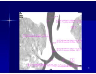 Radiology in Congenital Pulmonary Diseases - HCM UMP | PDF