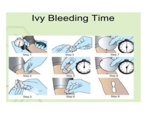 BT CT HESS TEST CLOT RETRACTION TIME.pptx
