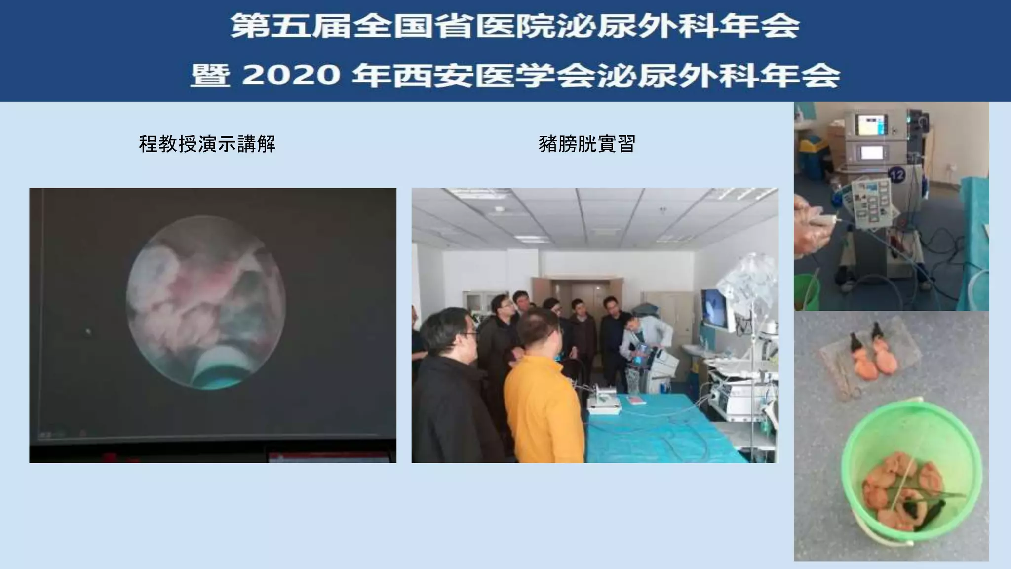 BTESD Bladder Tumor Endoscopic Submucosal Dissection development in ...