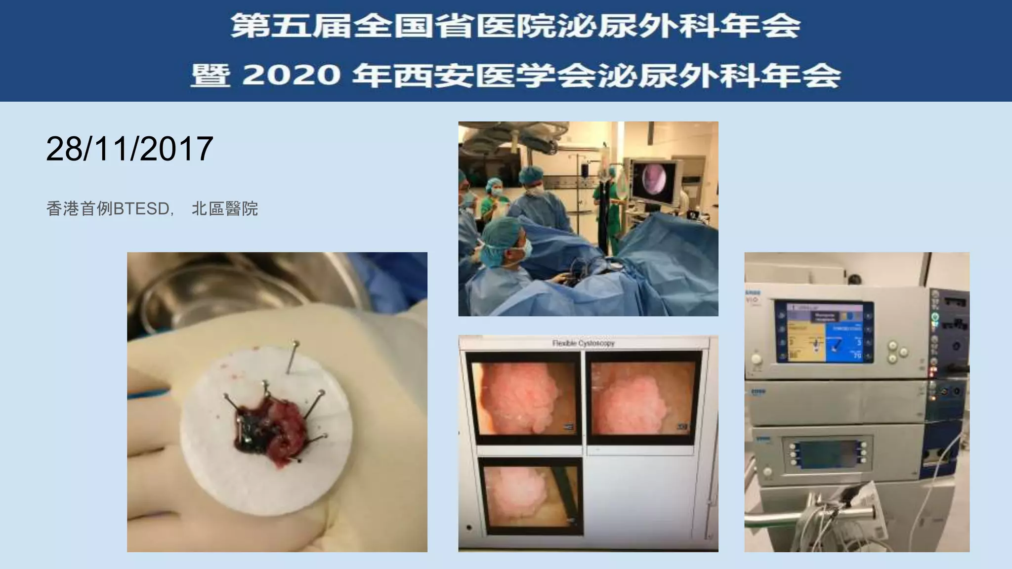 BTESD Bladder Tumor Endoscopic Submucosal Dissection development in ...