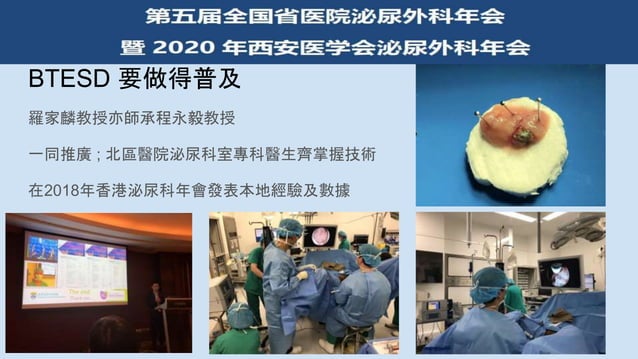 BTESD Bladder Tumor Endoscopic Submucosal Dissection development in ...