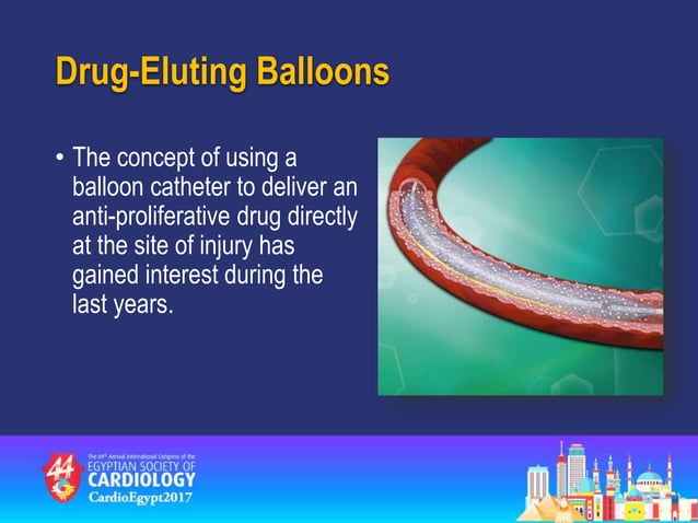 Below the knee intervention; balloons or stents | PPTX