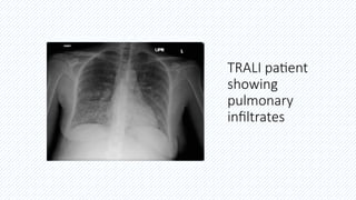 BT Reaction complication and Massive blood transfusion.pptx