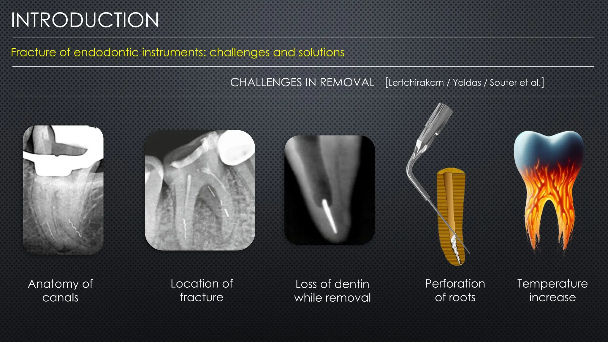 File Retrieval in Endodontics - BTR Pen. | PPTX