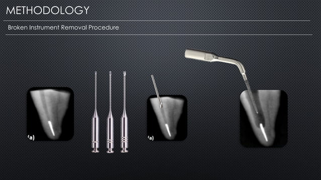 File Retrieval in Endodontics - BTR Pen. | PPTX