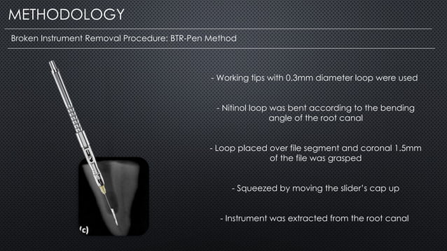 File Retrieval in Endodontics - BTR Pen. | PPTX