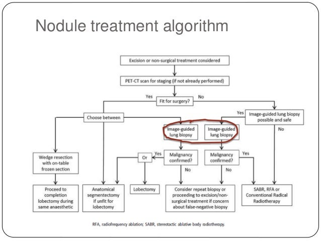 British Thoracic Society Guidelines on Lung nodules #Vama2015