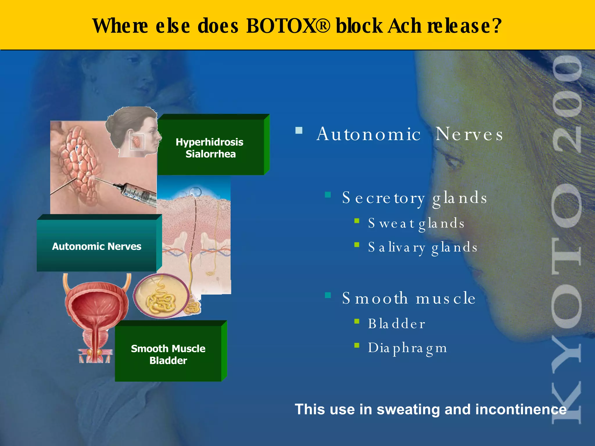 The Action of Botox on Migraine | PPT