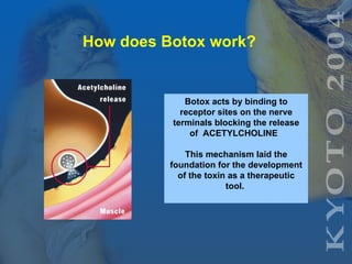 The Action of Botox on Migraine | PPT