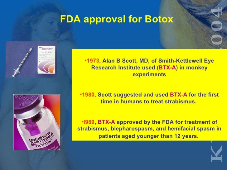 The Action of Botox on Migraine