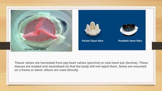 Medical Textile (implantable) | PPTX