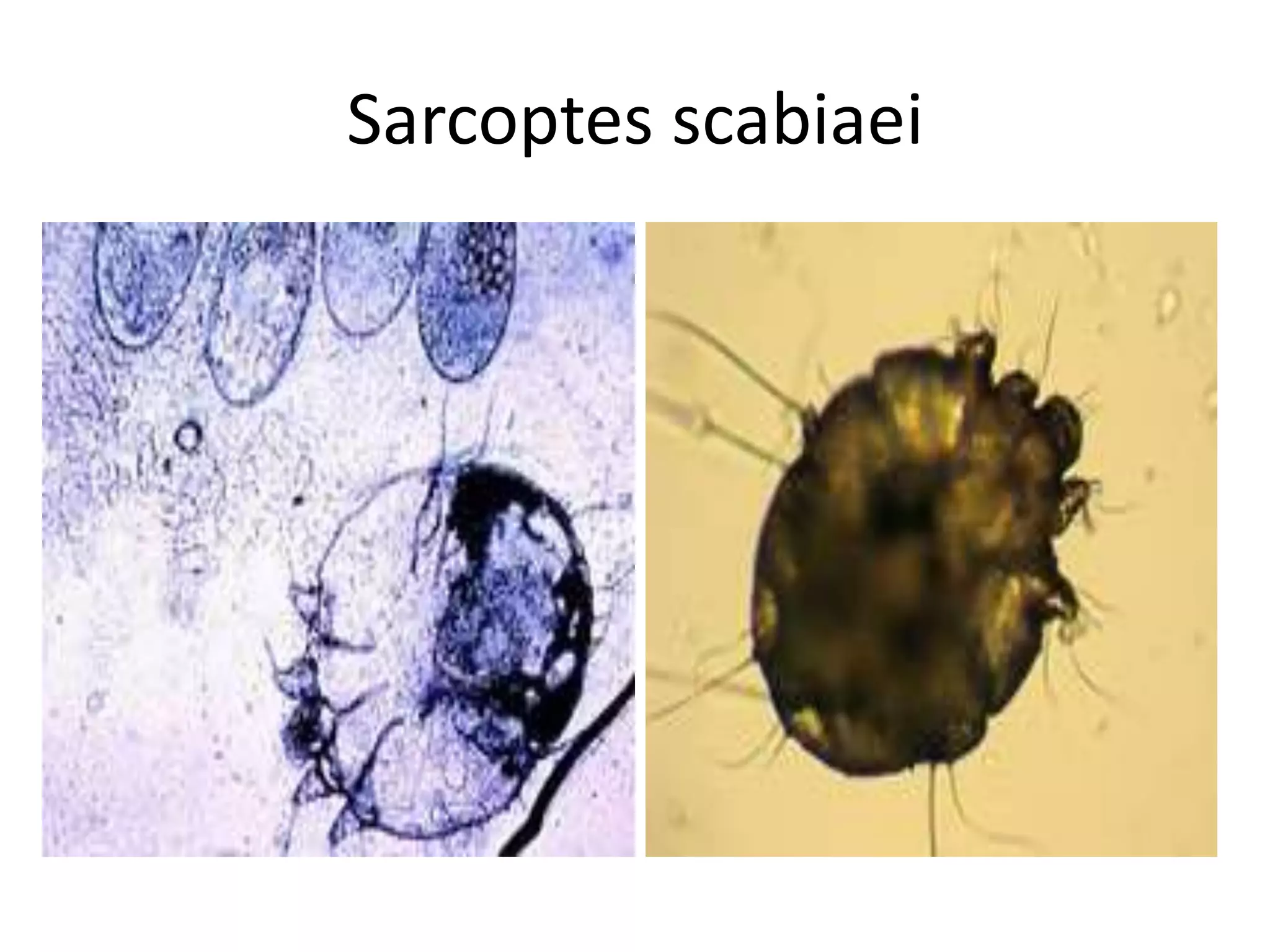 Skin_infestations_-_Copy_-_Copy_-_Copy.pptx | Skin and Dermatology ...