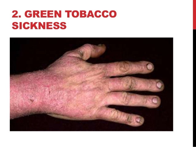 Tobacco Farming in Indonesia