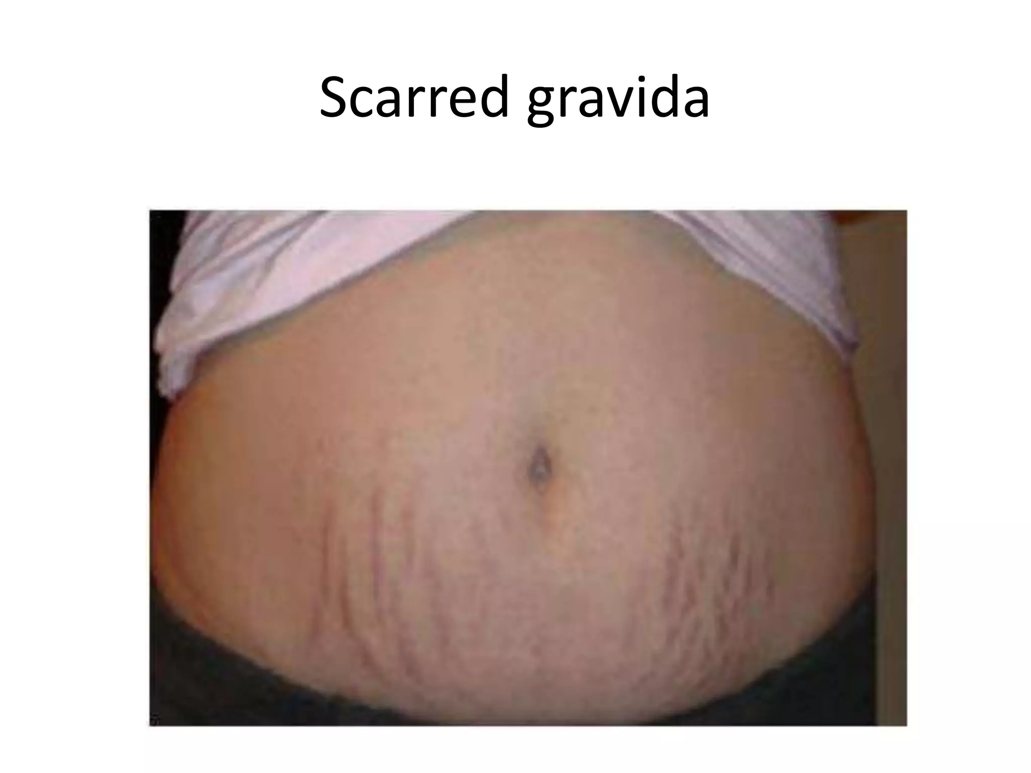 Postnatal Mother Examination - BUBBLE-HE | PPTX