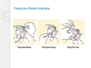Bubble cpap | PPTX