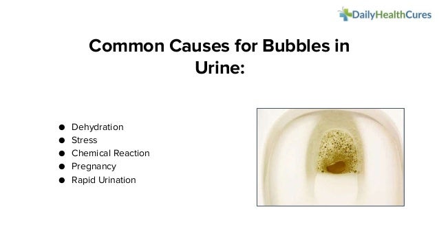 Bubbles in Urine: 9 Possible Causes and Treatment Options