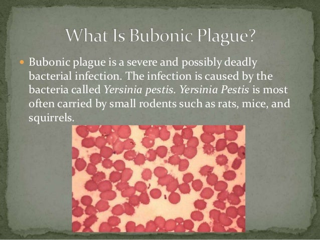 Bubonic plague