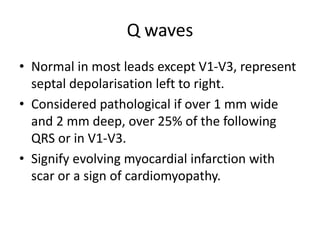 A Structured Method for ECG Interpretation | PPT