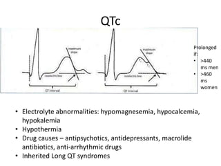 A Structured Method for ECG Interpretation | PPT