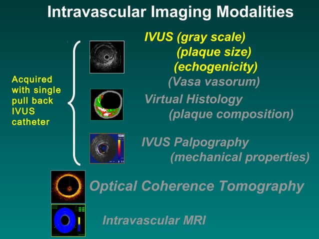 Existing intravascular imaging technology for plaque characterization | PPT