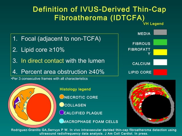 Existing intravascular imaging technology for plaque characterization | PPT
