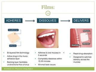 Buccal Administration
