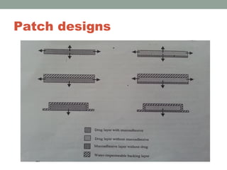 Buccal bioadhesive drug delivery system G1ppt | PPT