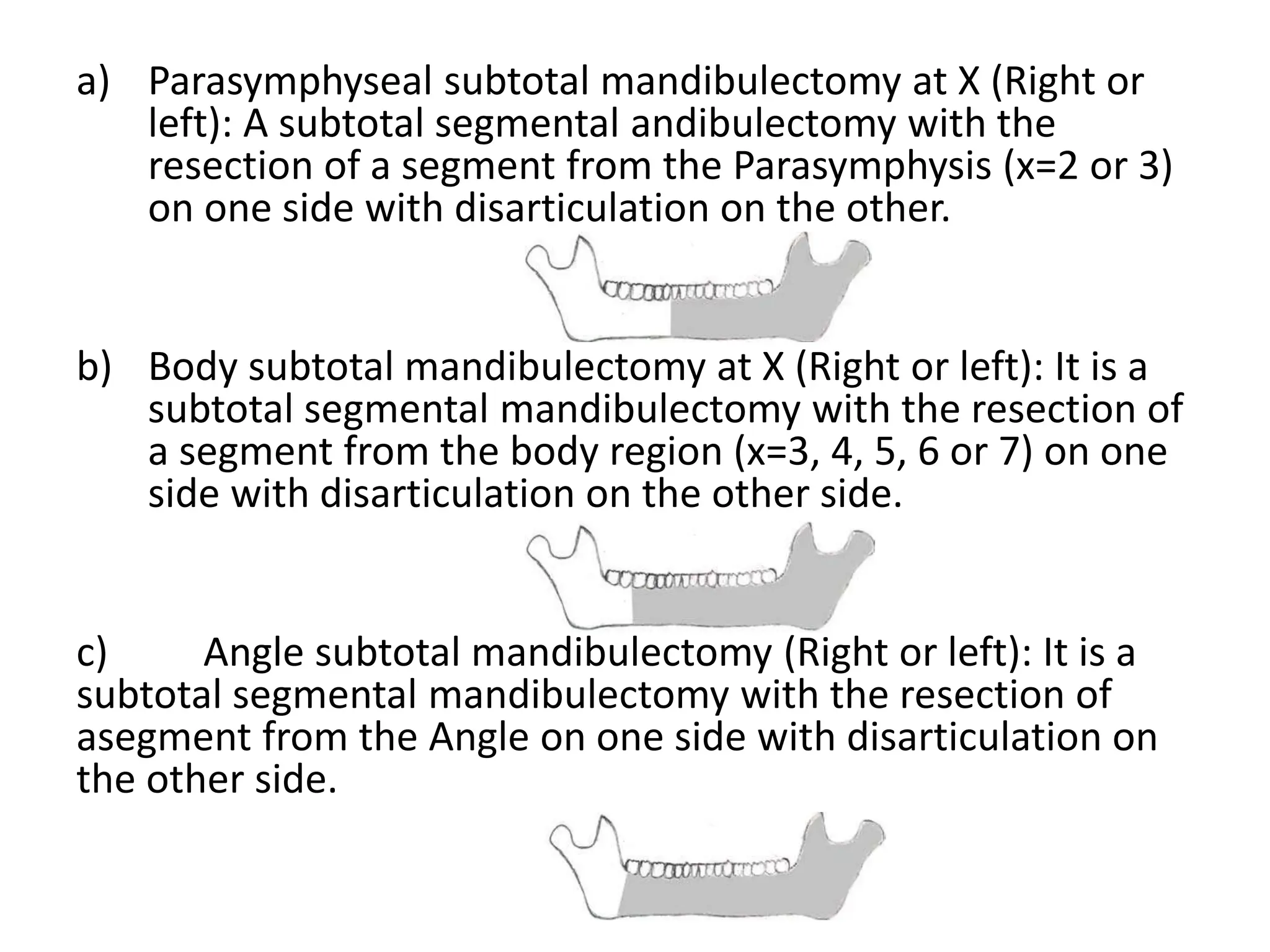 BUCCAL CARCINOMA - Disease and Management | PPTX