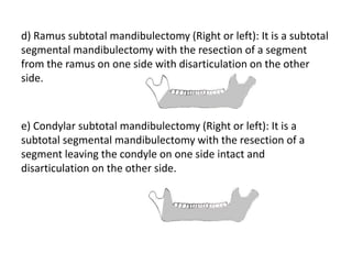 BUCCAL CARCINOMA - Disease and Management | PPTX